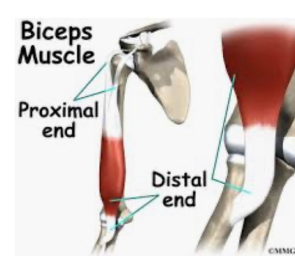Biceps Ruptures | ISMI